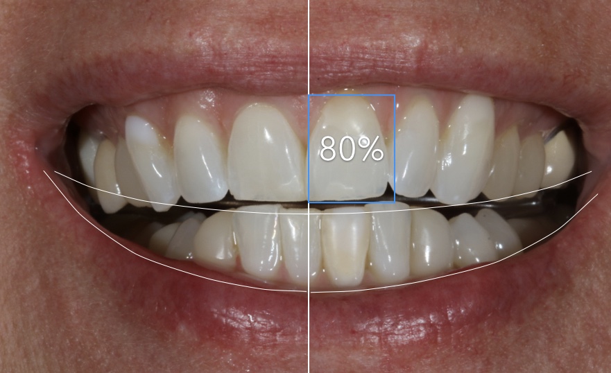 What does your height and width have to do with smilewellness? – Dr ...