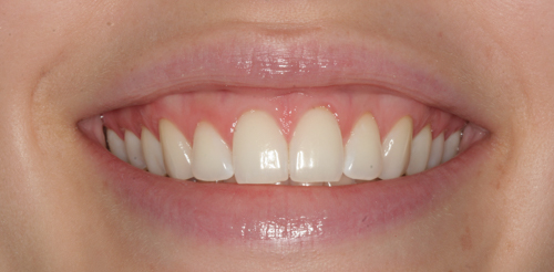 How much do you show? – Dr. Bill Papadopoulos